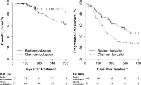 Segmental Yttrium 90 Radioembolization Versus Segmental