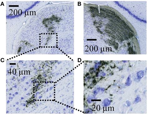 High Resolution Views Of Retinal Termini In The Dlgn As Visualized By
