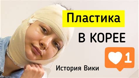ЛИФТИНГ ПЛАСТИКА В КОРЕЕ Пластическая операция Вики 🥰 Youtube