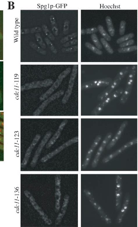 Figure 4 From The Spindle Pole Body Protein Cdc11p Links Sid4p To The