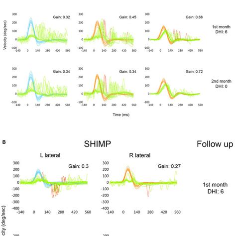 Vhit Comparison Of Superimposed Head [right Red Left Blue] And Eye Download Scientific