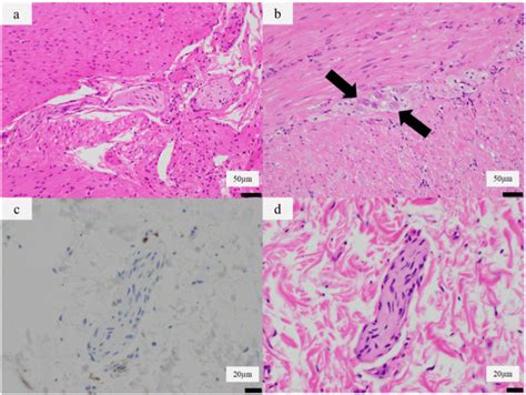 Histopathological Findings A B Auerbachs And Meissners Plexus Download Scientific Diagram