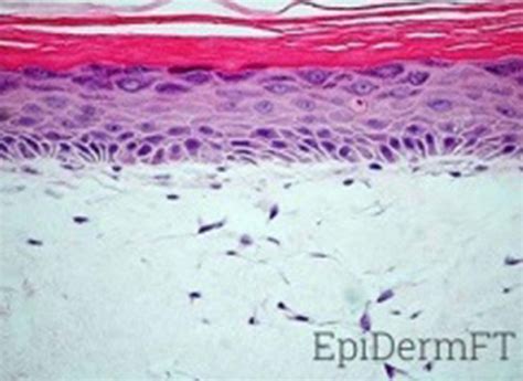 Histology Of Epidermft Hande Stained Paraffin Section Reveals Epidermis Download Scientific