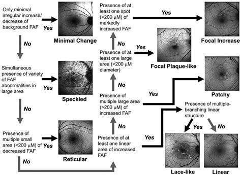 Flow Chart For Classifying Abnormal Faf Download Scientific Diagram