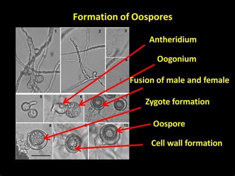 Lecture 9 Sexual Reproduction In Fungi Pptx Infertility