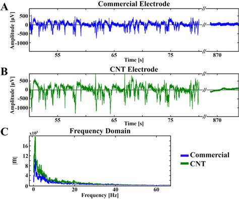 Simultaneous Bilateral Comparison Of Local Field Potential Signals And Download Scientific