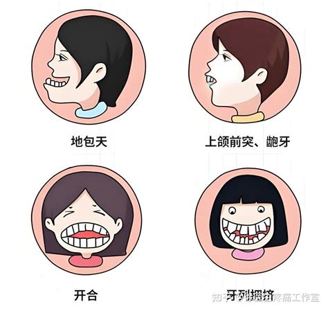 错颌畸形：不只是牙齿不整齐那么简单 知乎