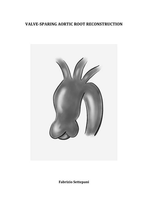 Pdf Valve Sparing Aortic Root Reconstruction