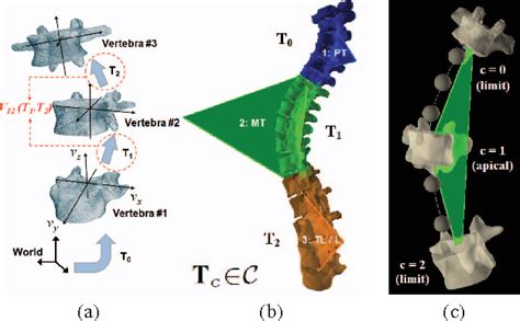 Figure 2 From Multimodal Inference Of Articulated Spine Models From