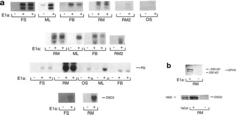 Expression Of Desmosomal Proteins In Ela Expressing Cell Lines Rnas Download Scientific