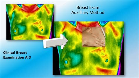 The Breast Thermography Journal Digital Infrared Analysis