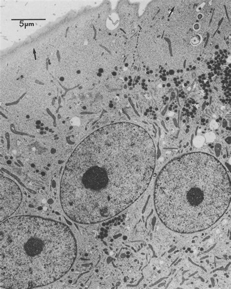 Typical Ultrastructural Morphology Of A Cultured Multinucleated Cell Download Scientific