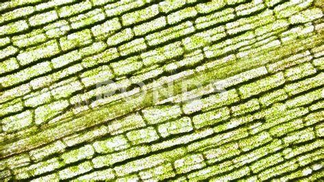 Elodea Cells Under A Microscope