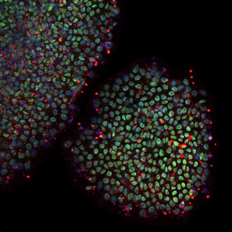 How To Measure Cell Culture Confluency Cell And Gene Therapy Catapult Posted On The Topic