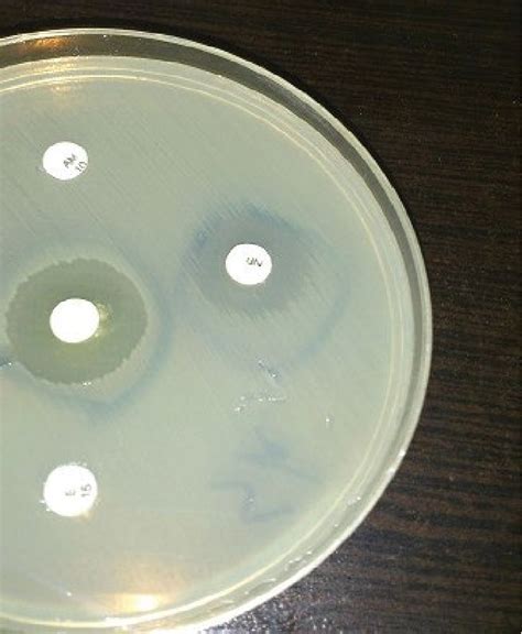 Disc Diffusion Test Download Scientific Diagram