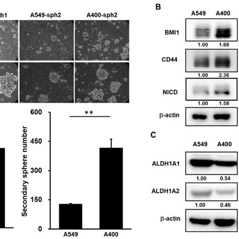 Cancer Stem Cell Csc Activity And Epithelial To Mesenchymal