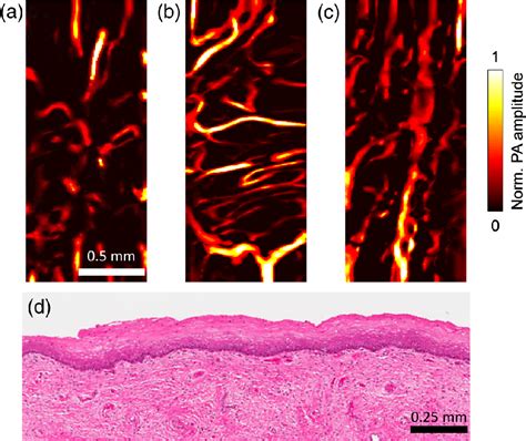 Transvaginal Fast Scanning Optical Resolution Photoacoustic Endoscopy