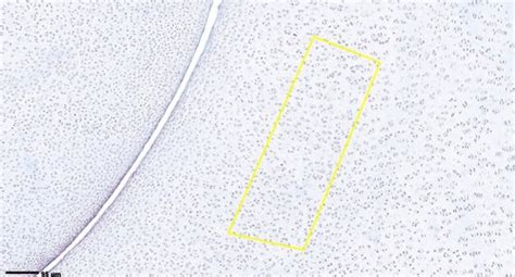 Cot Quiz 3 Flashcards Quizlet