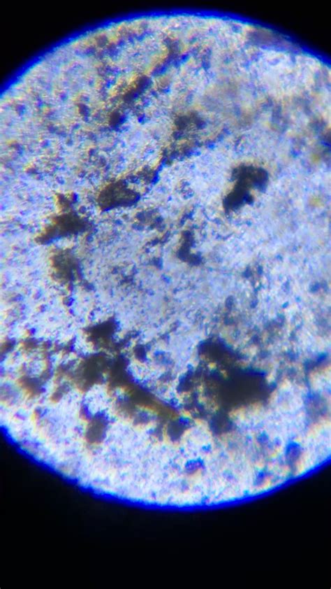 Are The Tiny Swimming Blobs Bacteria 250x Pond Water Rmicroscopy