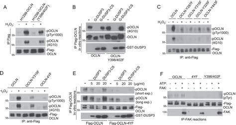 Dusp3 Regulates Phosphorylation Mediated Degradation Of Occludin And Is