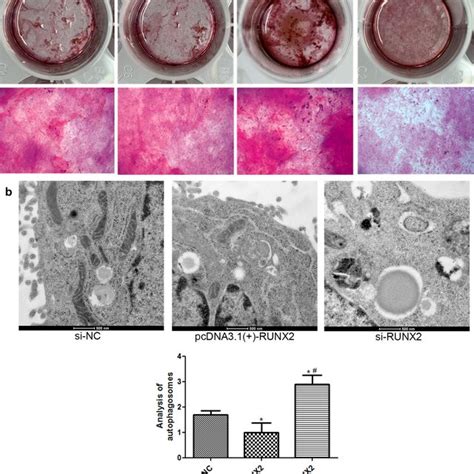 Effects Of Runt Related Transcription Factor 2 Runx2 On Osteoblast