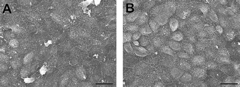 Behavior Of Fetal Rpe On Bruchs Membrane After Freeze Thaw And Cm