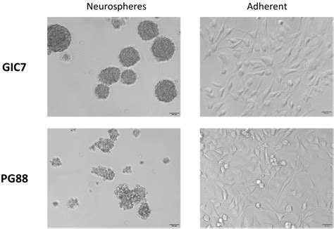 Icmab Synchrotron Based Fourier Transform Infrared Micro Spectroscopy Sr Ftirm Fingerprint