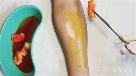 Técnicas De Antisepsia Youtube