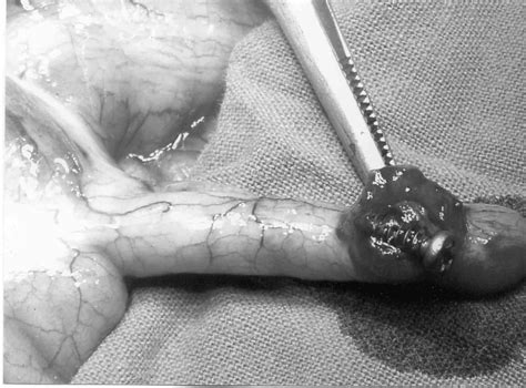 Indian Pediatrics Editorial