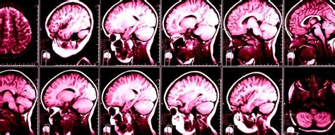 Everybody Has A Distinct Memory Style That Affects How We Recall Things Psychology Careers