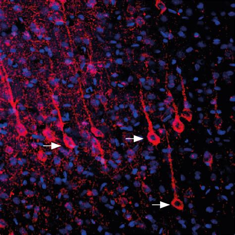 Immunohistochemistry Ihc Protocols For Frozen Sections Indirect Methods Alomone Labs