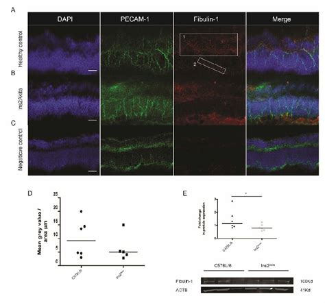Figure 1 From Possible Role Of Fibulin 1 In The Extracellular Matrix Organization Of The Retina