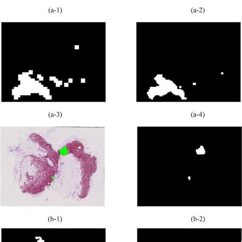 Similarity Metric Optimization A 1 Validation Image From Paip2020 Download Scientific