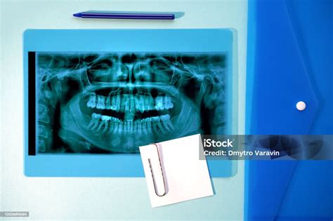 텍스트 폴더 및 펜에 대한 빈 흰색 종이와 파노라마 치과 치아 엑스레이 필름 위의 보기 X 레이에 대한 스톡 사진 및 기타 이미지 Istock