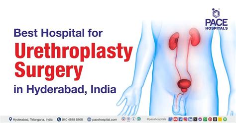 Urethroplasty Surgery In Hyderabad Schedule Appointment