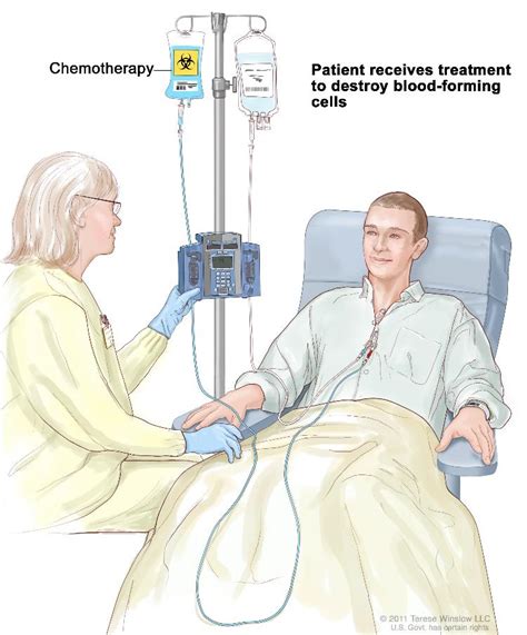 Leukemia Treatment Chemotherapy