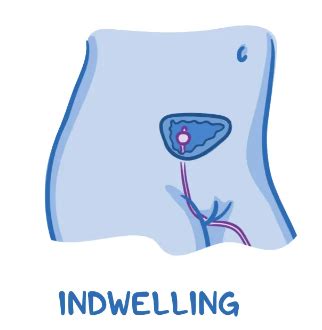 Micro III Pre Analytical Considerations Specimen Processing Flashcards Quizlet