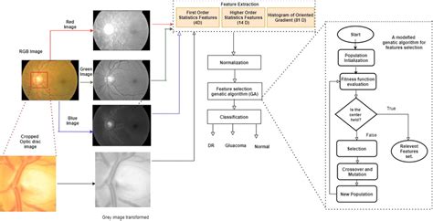 Block Diagram Of The Proposed Retinal Computer Aided Diagnosis System Download Scientific Diagram