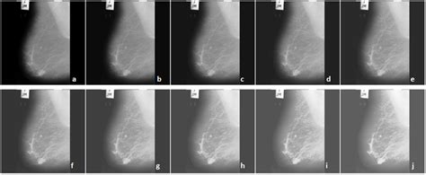 Results Of Histogram Modification Function For Different α Values Here