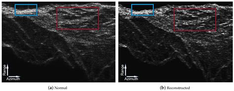 Application Of Quasi Continuous Waveform Coding In Spaceborne Synthetic Aperture Radar