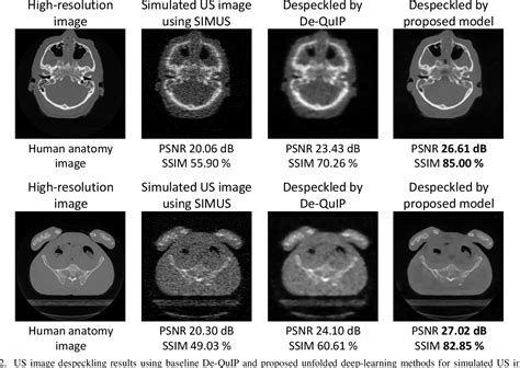 Figure 1 From Adaptive Contrast Enhancement Of Cardiac Ultrasound