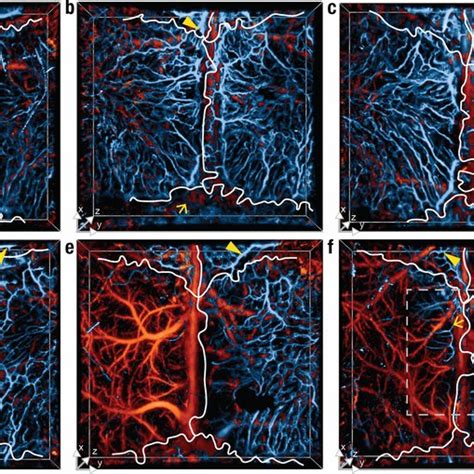 Volumetric Segmentation Of Microvasculature In Radiated And Download Scientific Diagram