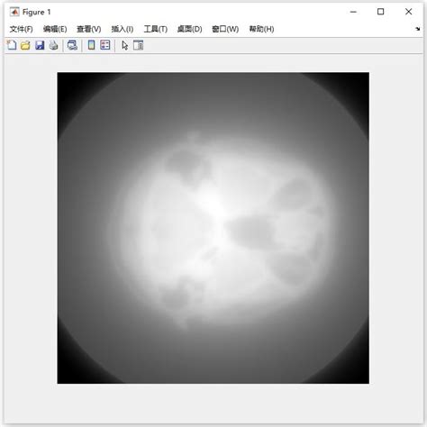【b263】基于matlab ct图像重建 图像处理 索炜达电子