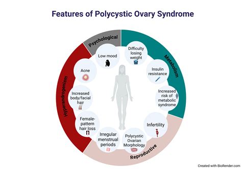 Pcos Acne Polycystic Ovary Syndrome Pcos Endocrine Conditions