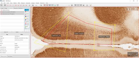 Qupath Intersect Annotations And Keep Original Object Usage And Issues