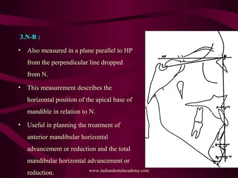 COGS Analysis Cephelometrics For Orthognathic Surgery Fixed Orthodontics Courses India PPT