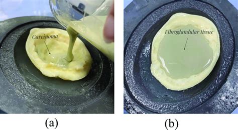 A Carcinoma TMM Inside The Adipose Layer B The Fibroglandular TMM Download Scientific