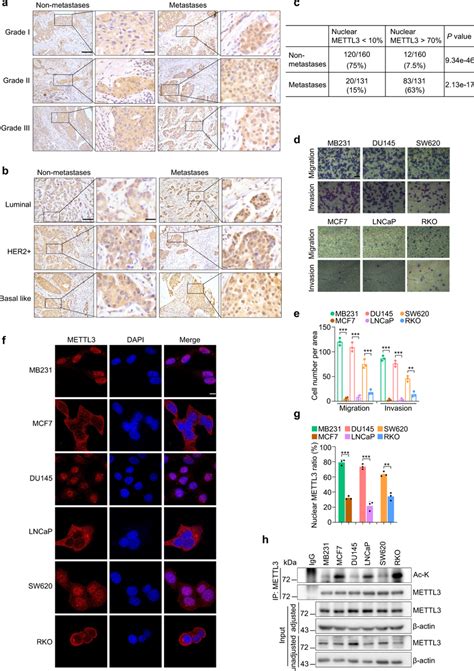 Mettl3 Nuclear Accumulation Correlates With Node Metastasis And Download Scientific Diagram
