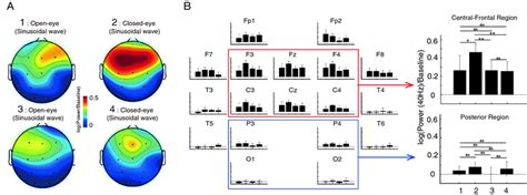 Comparison Of The Entrainment Effect In 40 Hz Neural Response Among The Download Scientific