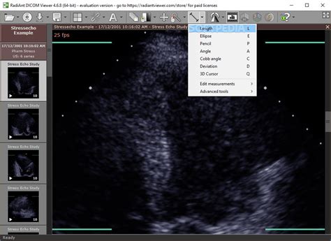 Free Windows 10 Dicom Viewer Keenbery